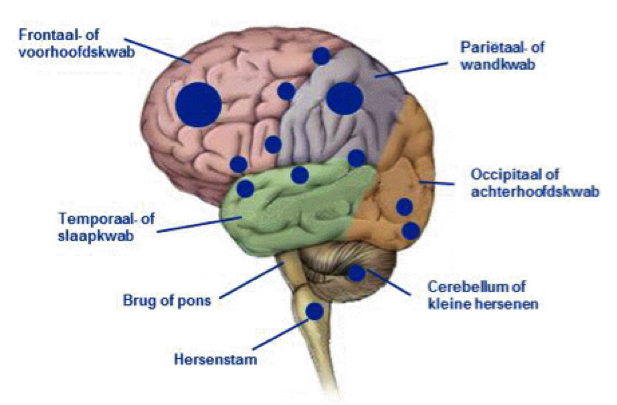 Alcohol en het Brein (Deel I) - PsyBlogNL